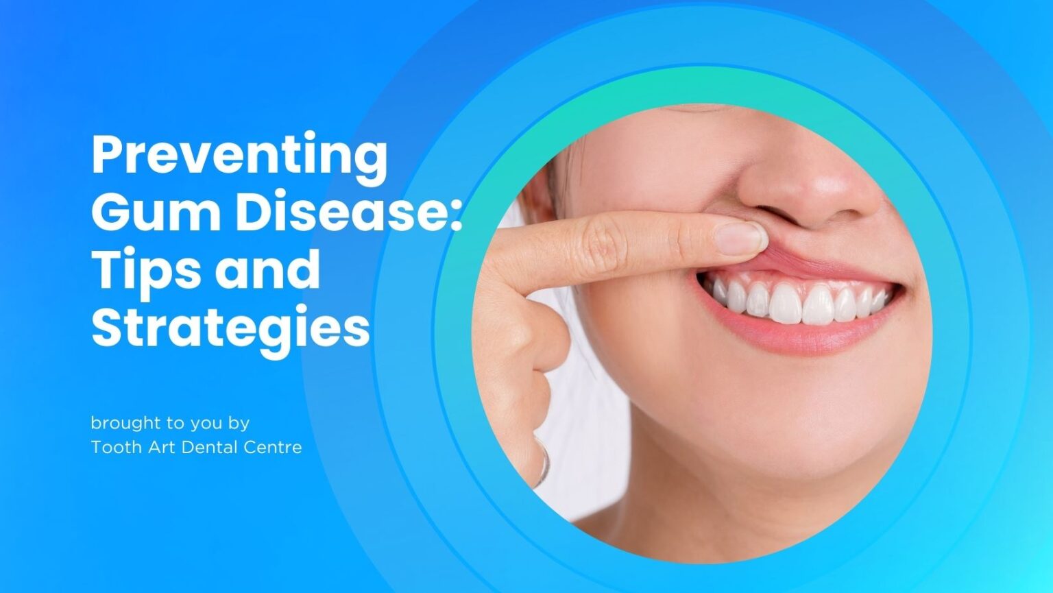 Tooth Art Dental Centre - Tips on Preventing Gum Disease
