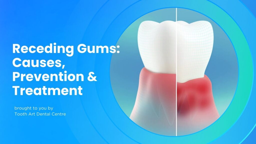 Tooth Art Dental Centre - Receding Gums: Causes, Prevention &Treatment
